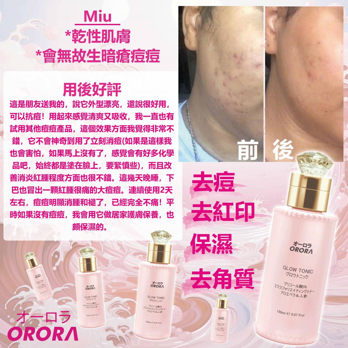 日本Orora嫩肌去角質精華水150ml - MsSakura 專注品質生活