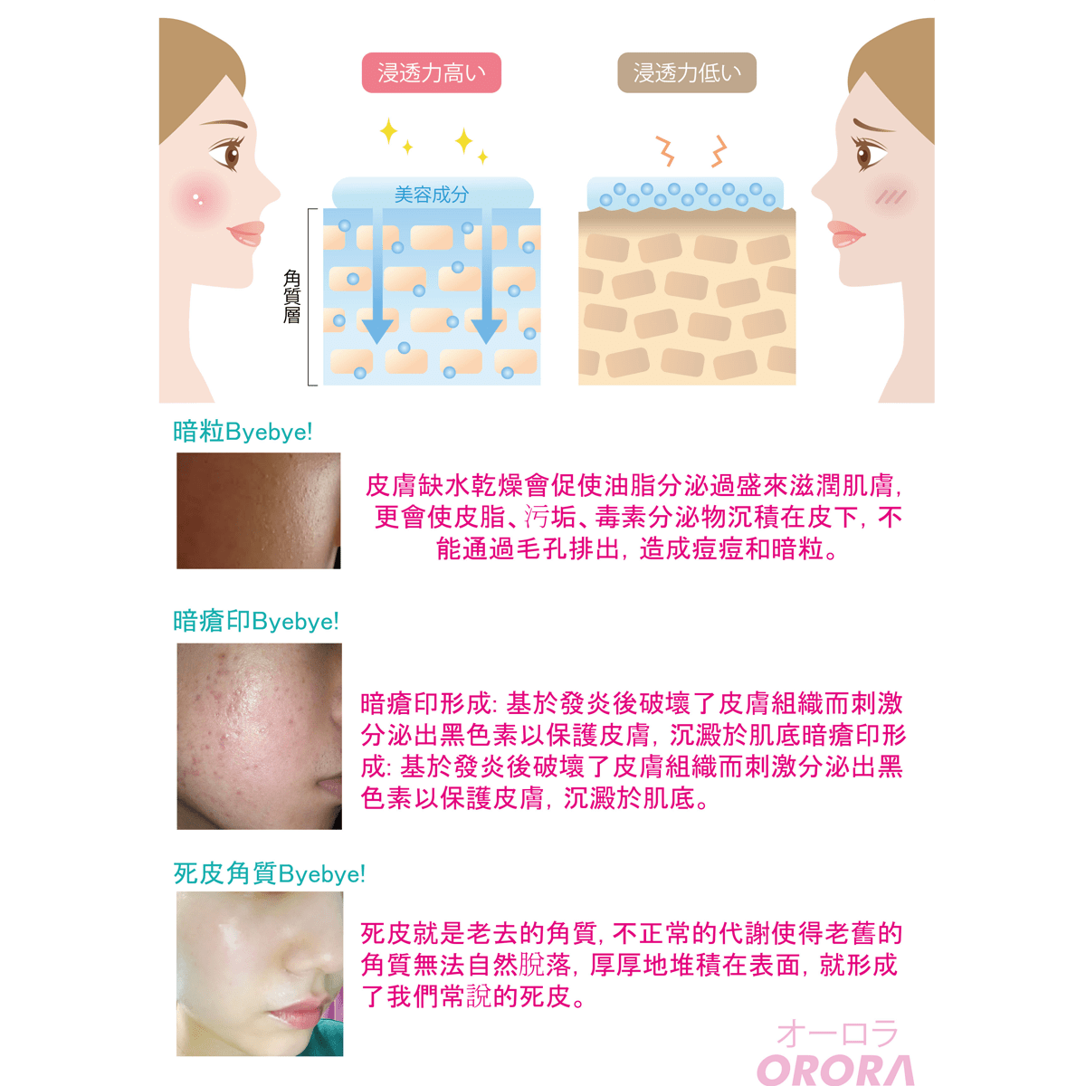 日本Orora嫩肌去角質精華水150ml - MsSakura 專注品質生活