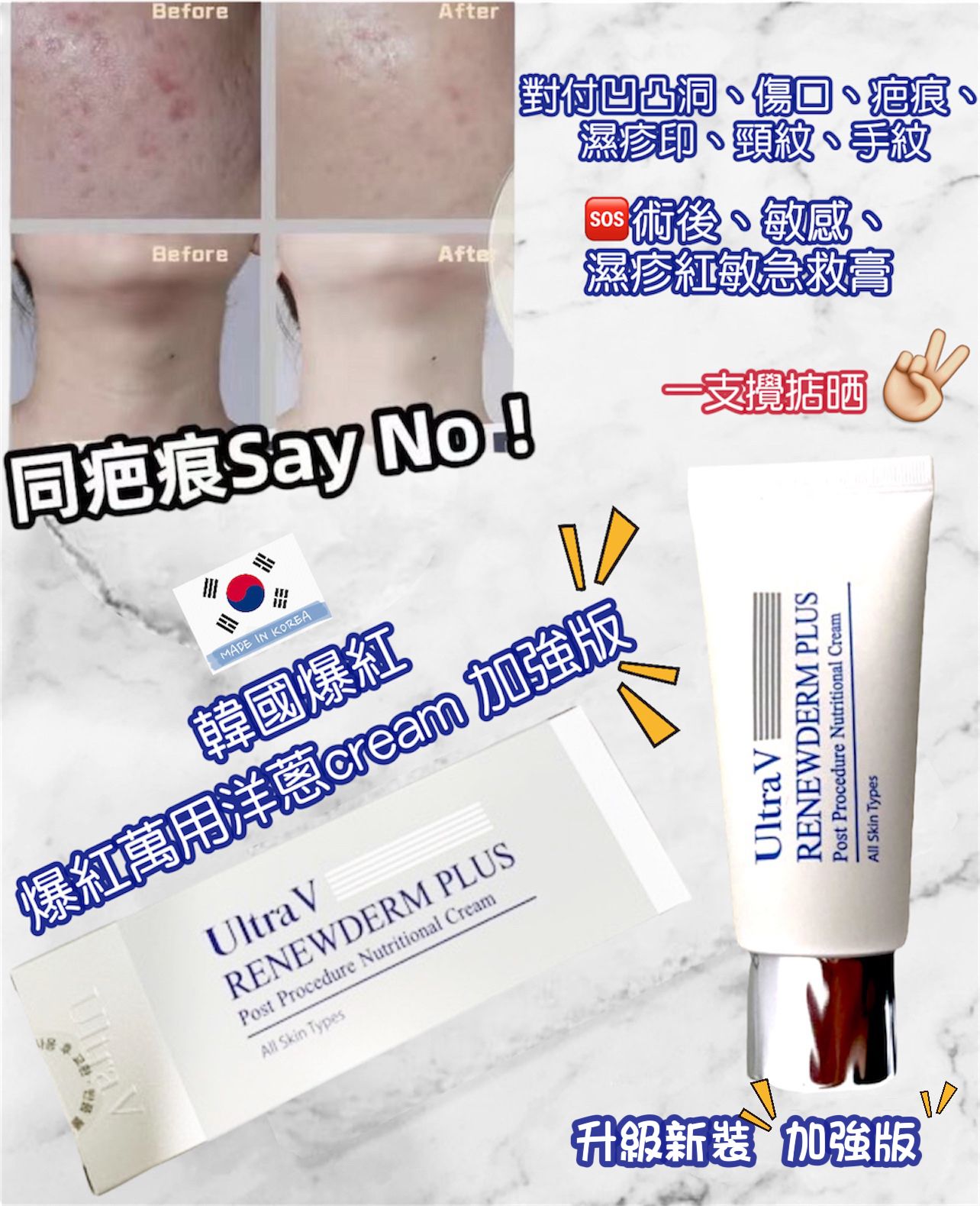 韓國直送Ultra V DDK 再生修復膏 50ml 洋蔥Cream 正品行貨有雷射貼紙 - MsSakura 專注品質生活