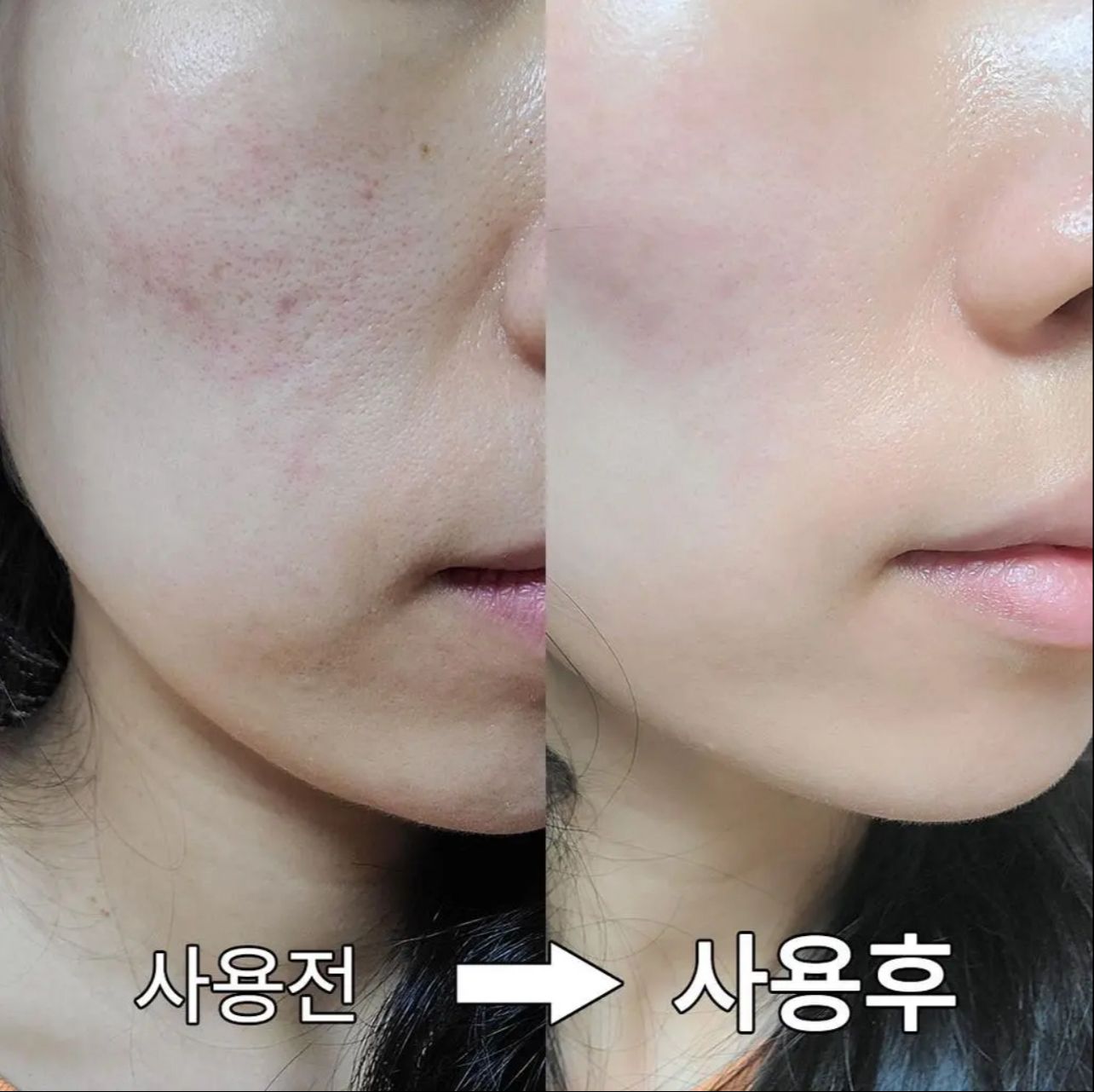 韓國製Res novae Core Impact 4合1少女機(首批訂購送價值$500護膚套裝 送完即止) 香港行貨1年保養 - MsSakura 專注品質生活